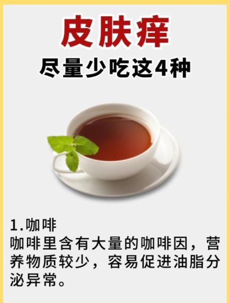 慢性荨麻疹不能吃什么_慢性荨麻疹忌口食物清单-第2张图片-山城妙识 慢性荨麻疹不能吃什么_慢性荨麻疹忌口食物清单-第2张图片-山城妙识
