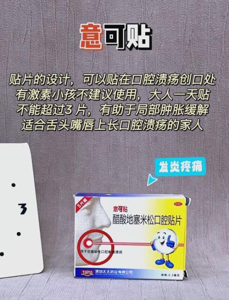 口腔溃疡吃什么药好_口腔溃疡怎么快速止痛-第1张图片-山城妙识