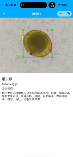 如何判断自己体内有寄生虫_寄生虫检测方法有哪些-第1张图片-山城妙识