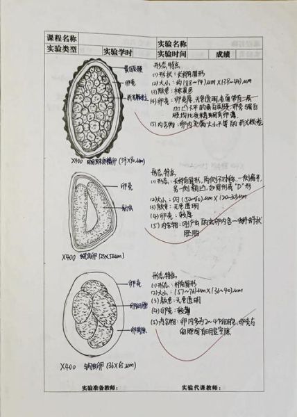 如何判断自己体内有寄生虫_寄生虫检测方法有哪些-第3张图片-山城妙识