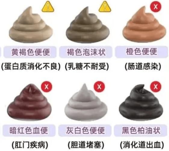 早期肠癌大便图片_肠癌大便颜色形状变化-第3张图片-山城妙识