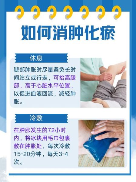 土豆片消肿能敷一夜吗_土豆片敷脸过夜安全吗-第2张图片-山城妙识