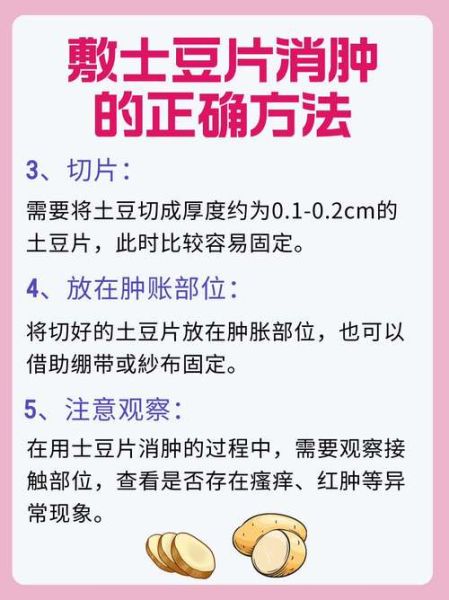 土豆片消肿能敷一夜吗_土豆片敷脸过夜安全吗-第1张图片-山城妙识