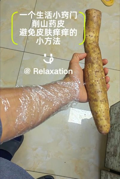 削山药皮后手痒怎么办_山药黏液止痒最快方法-第2张图片-山城妙识 削山药皮后手痒怎么办_山药黏液止痒最快方法-第2张图片-山城妙识