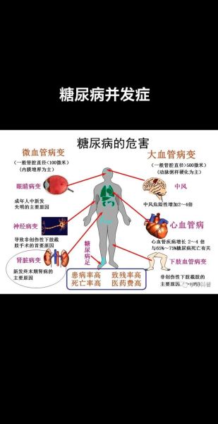 糖尿病恶化有哪些症状_糖尿病恶化的十大症状-第1张图片-山城妙识