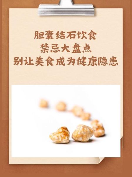 胆结石不能吃什么食物_胆结石饮食禁忌有哪些-第2张图片-山城妙识