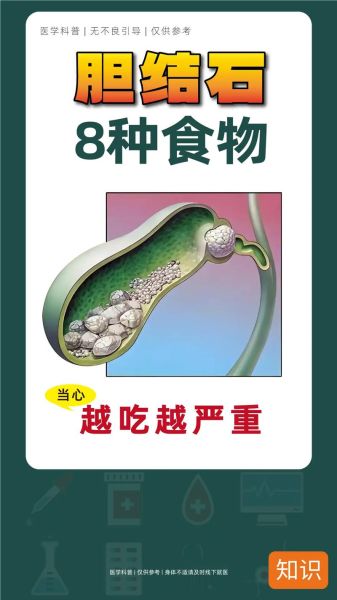 胆结石不能吃什么食物_胆结石饮食禁忌有哪些-第3张图片-山城妙识