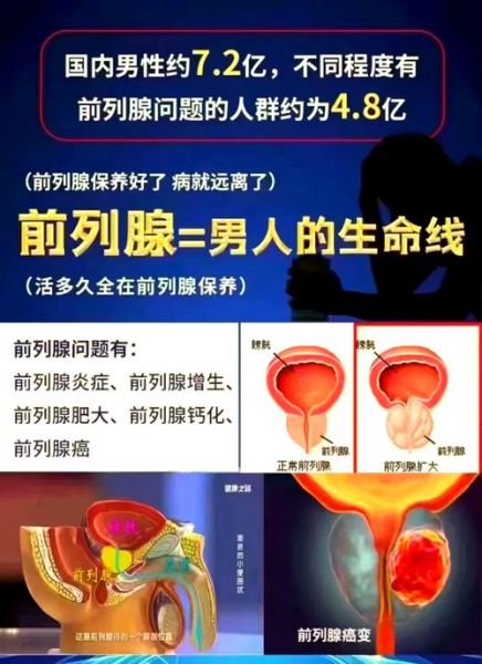 spa前列腺保养是做什么_前列腺保养spa流程-第2张图片-山城妙识 spa前列腺保养是做什么_前列腺保养spa流程-第2张图片-山城妙识