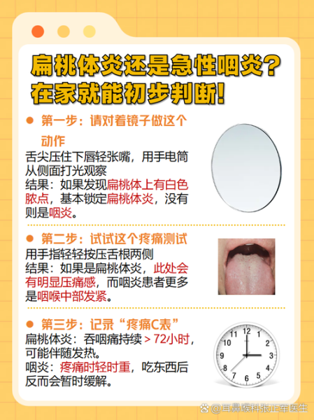 咽炎和咽喉炎的区别_症状一样吗-第2张图片-山城妙识