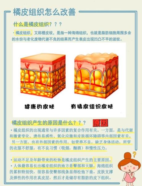 橘皮组织怎么消除_橘皮组织是怎么形成的-第3张图片-山城妙识 橘皮组织怎么消除_橘皮组织是怎么形成的-第3张图片-山城妙识