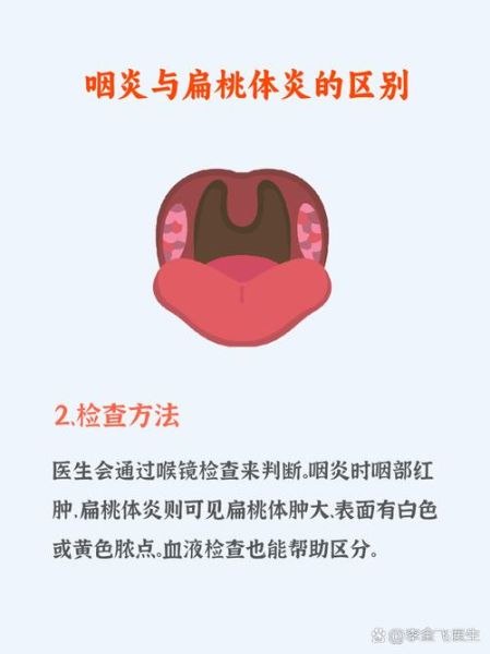 咽炎和扁桃体炎的区别_如何判断咽炎还是扁桃体炎-第1张图片-山城妙识 咽炎和扁桃体炎的区别_如何判断咽炎还是扁桃体炎-第1张图片-山城妙识