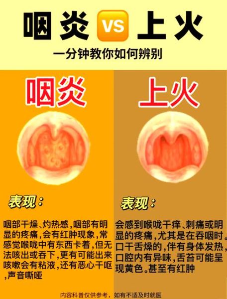咽炎和扁桃体炎的区别_如何判断咽炎还是扁桃体炎-第2张图片-山城妙识 咽炎和扁桃体炎的区别_如何判断咽炎还是扁桃体炎-第2张图片-山城妙识