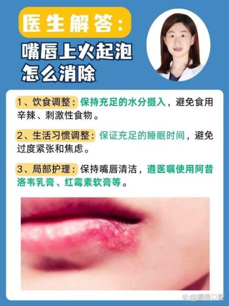 嘴唇起泡是什么原因_睡一觉醒来上唇肿了怎么办-第2张图片-山城妙识
