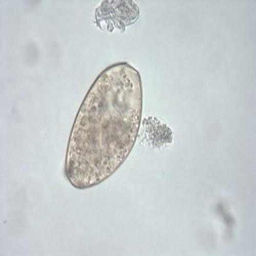 姜片虫卵长什么样_姜片虫卵感染症状有哪些-第1张图片-山城妙识