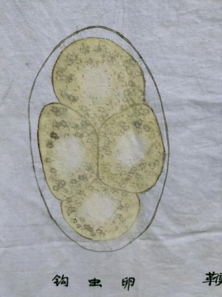 姜片虫卵长什么样_姜片虫卵感染症状有哪些-第3张图片-山城妙识