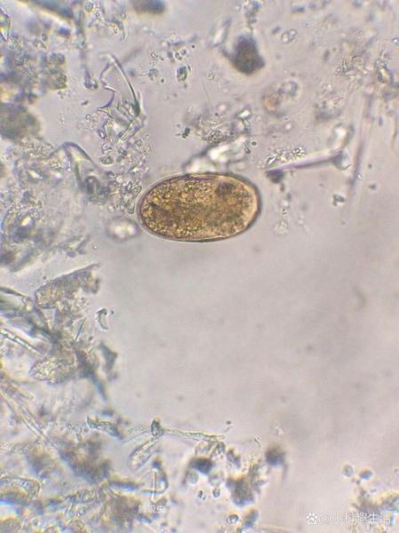 姜片虫卵长什么样_姜片虫卵感染症状有哪些-第2张图片-山城妙识