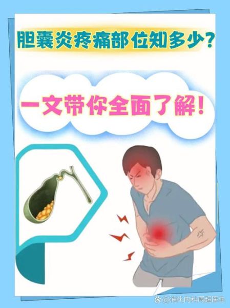 女性胆囊炎有什么症状_胆囊炎疼痛位置在哪-第3张图片-山城妙识 女性胆囊炎有什么症状_胆囊炎疼痛位置在哪-第3张图片-山城妙识