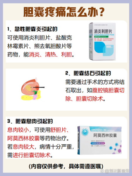 女性胆囊炎有什么症状_胆囊炎疼痛位置在哪-第1张图片-山城妙识 女性胆囊炎有什么症状_胆囊炎疼痛位置在哪-第1张图片-山城妙识