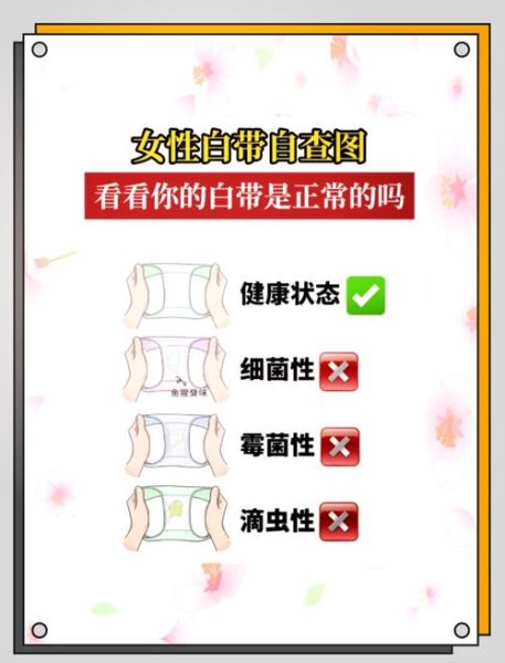 豆腐渣样白带是什么感染_怎么治疗-第1张图片-山城妙识