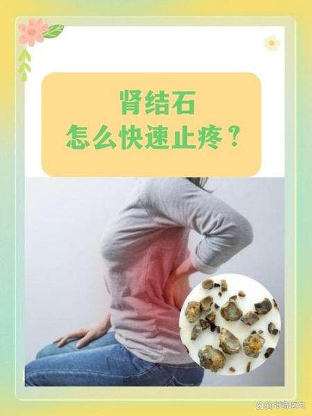 肾结石最快的止痛方法_如何缓解肾结石疼痛-第1张图片-山城妙识 肾结石最快的止痛方法_如何缓解肾结石疼痛-第1张图片-山城妙识