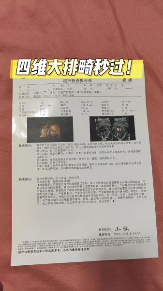 大排畸和四维都要做吗_四维和大排畸区别-第2张图片-山城妙识 大排畸和四维都要做吗_四维和大排畸区别-第2张图片-山城妙识