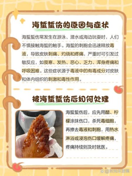 被海蜇咬了什么症状_被海蜇咬了怎么办-第1张图片-山城妙识