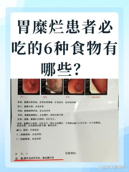 胃糜烂吃什么食物养胃_胃糜烂饮食禁忌有哪些-第3张图片-山城妙识