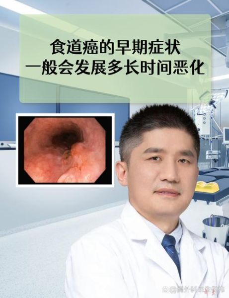 食道癌早期15种征兆有哪些_食道癌早期能治好吗-第3张图片-山城妙识