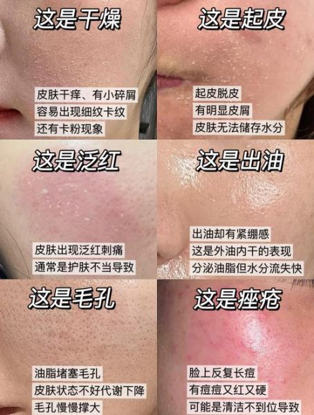 皮肤干燥起皮怎么办_身体干痒脱屑怎么快速缓解-第1张图片-山城妙识 皮肤干燥起皮怎么办_身体干痒脱屑怎么快速缓解-第1张图片-山城妙识