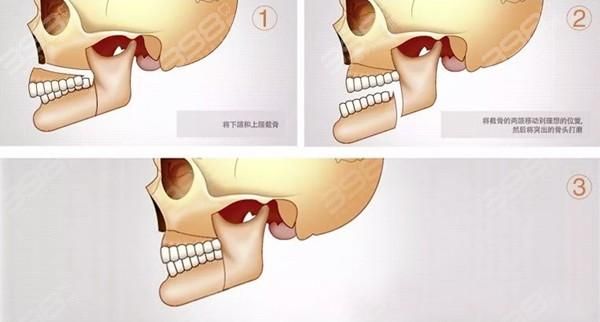 颌怎么读_颌字发音及常见误区-第3张图片-山城妙识
