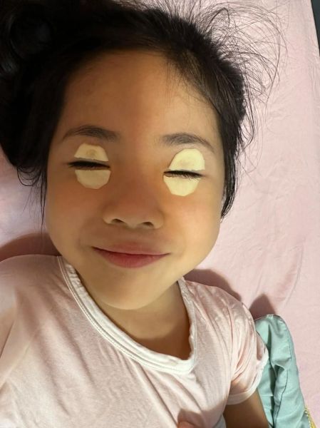 土豆片去黑眼圈的正确方法_土豆片敷眼多久见效-第1张图片-山城妙识