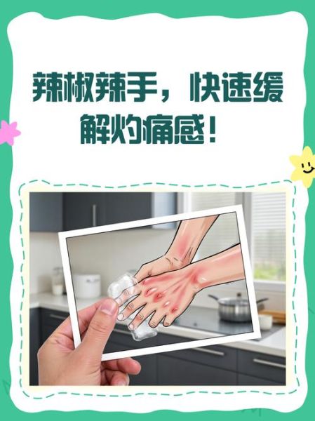 手指灼烧感又辣怎么办_辣椒辣手最快缓解方法-第3张图片-山城妙识 手指灼烧感又辣怎么办_辣椒辣手最快缓解方法-第3张图片-山城妙识