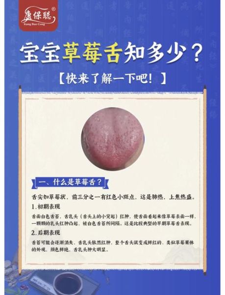 草莓舌怎么治疗_草莓舌多久能好-第3张图片-山城妙识