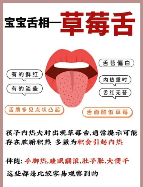 草莓舌怎么治疗_草莓舌多久能好-第2张图片-山城妙识