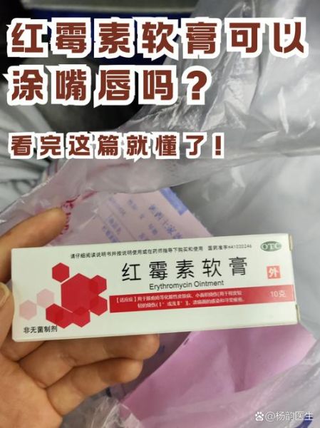 嘴唇上长水泡可以涂红霉素软膏吗_多久能好-第3张图片-山城妙识