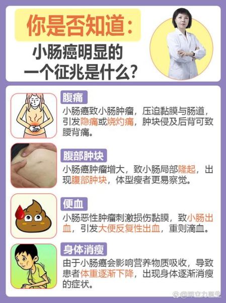 肠癌的早期症状有哪些_肠癌前兆会持续多久-第1张图片-山城妙识