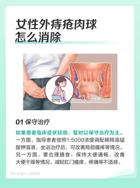 痔疮肉球怎么消除_痔疮肉球消除小偏方-第3张图片-山城妙识