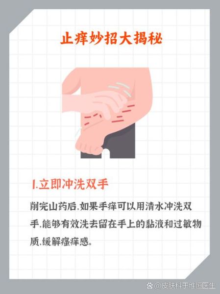 山药痒手怎么办_最快止痒方法-第3张图片-山城妙识