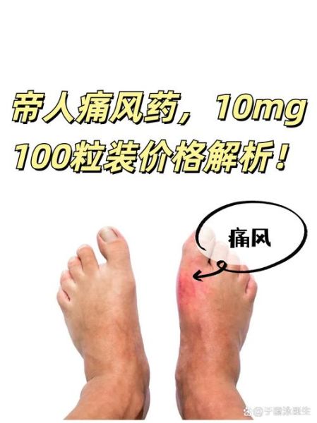 尿酸高吃什么药降尿酸_降尿酸药有哪些-第3张图片-山城妙识