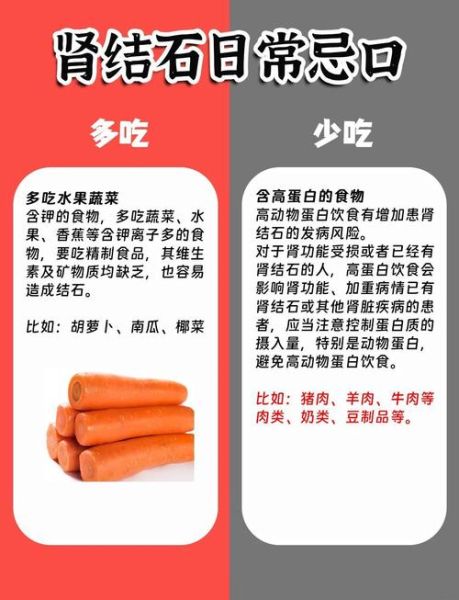 肾结石饮食应注意什么_肾结石不能吃什么-第1张图片-山城妙识