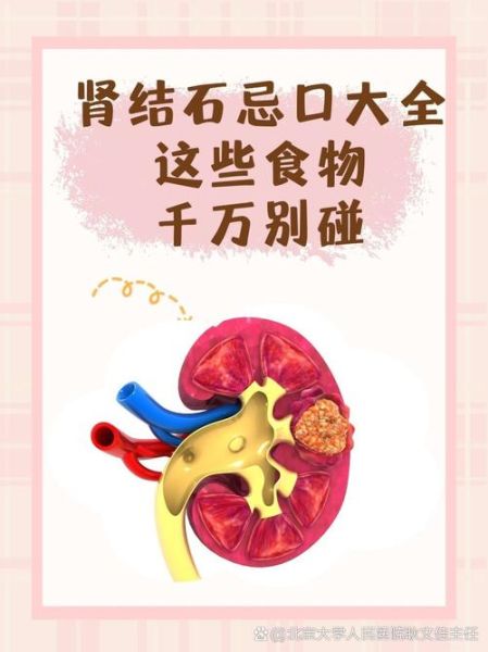 肾结石饮食应注意什么_肾结石不能吃什么-第2张图片-山城妙识