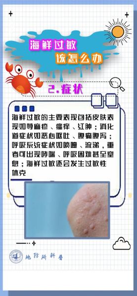 吃海鲜皮肤过敏怎么办_快速止痒小偏方-第2张图片-山城妙识 吃海鲜皮肤过敏怎么办_快速止痒小偏方-第2张图片-山城妙识