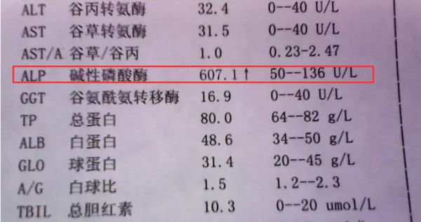 碱性磷酸酶偏高是什么原因_对身体有什么危害-第3张图片-山城妙识