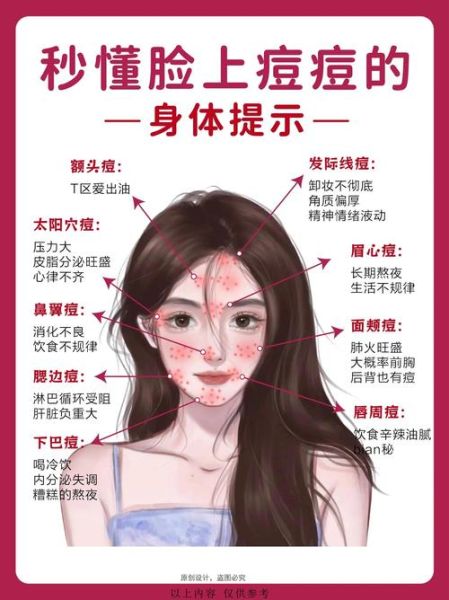 脸上长痘对应五脏示意图_如何调理-第2张图片-山城妙识 脸上长痘对应五脏示意图_如何调理-第2张图片-山城妙识