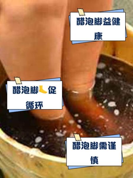 陈醋泡脚的正确方法_陈醋泡脚多久见效-第2张图片-山城妙识