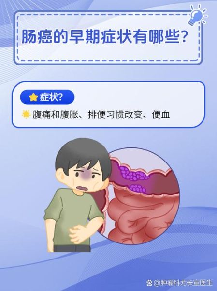 大肠癌的早期症状有哪些_如何及时发现-第3张图片-山城妙识