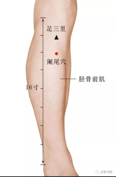 小偏方三天治好阑尾炎_真的靠谱吗-第3张图片-山城妙识 小偏方三天治好阑尾炎_真的靠谱吗-第3张图片-山城妙识