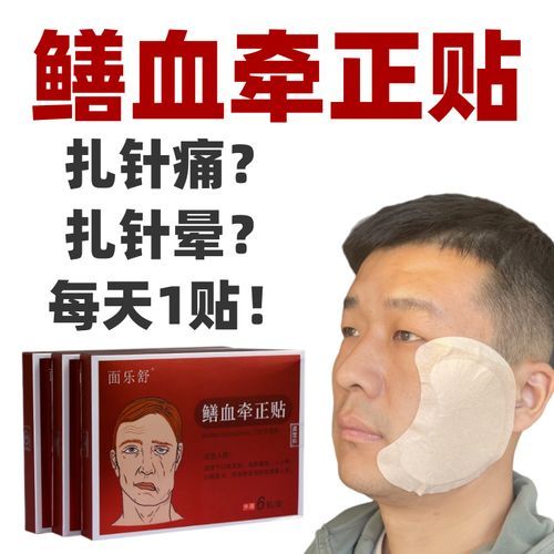 鳝鱼血治面瘫真的有用吗_鳝鱼血治面瘫偏方原理-第1张图片-山城妙识 鳝鱼血治面瘫真的有用吗_鳝鱼血治面瘫偏方原理-第1张图片-山城妙识