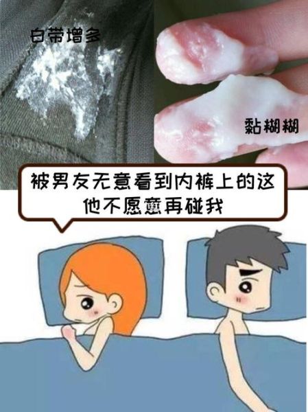 老公感染霉菌的症状_如何判断老公是否感染霉菌-第3张图片-山城妙识