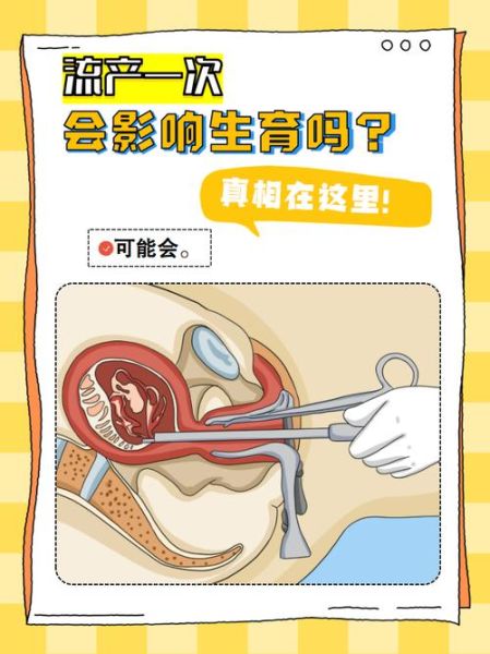 怎么自己流产_自己流产安全吗-第2张图片-山城妙识 怎么自己流产_自己流产安全吗-第2张图片-山城妙识